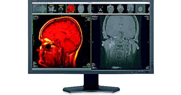 Display entspricht DICOM-Standard - MedTech-Komponenten - Elektroniknet
